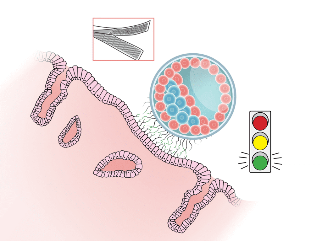 Endometrial Receptivity and ERA - The ObG Project