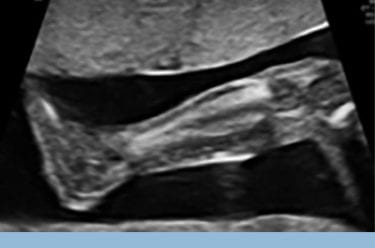 Wiley Figure 43 Fetal Extremities Featured - The ObG Project