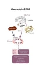 PCOS Part 1: Pathophysiology of PCOS - The ObG Project